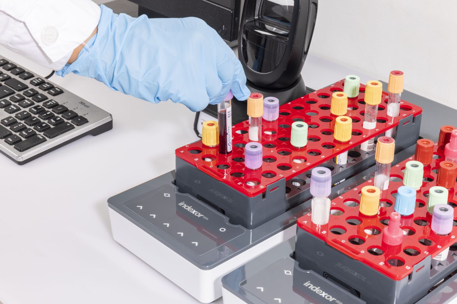 Upgrading urgent sample prioritization with indexor - Indexor